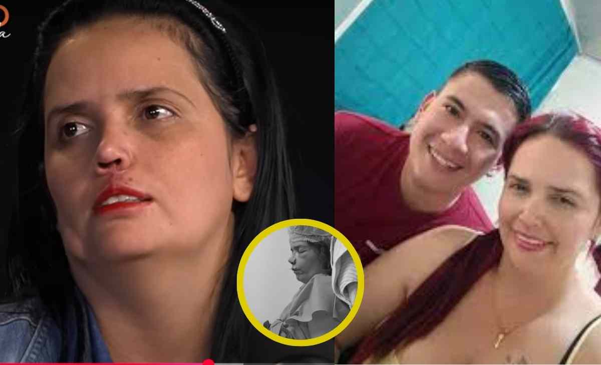 Cómo fue atacada una mujer a mordiscos por su expareja